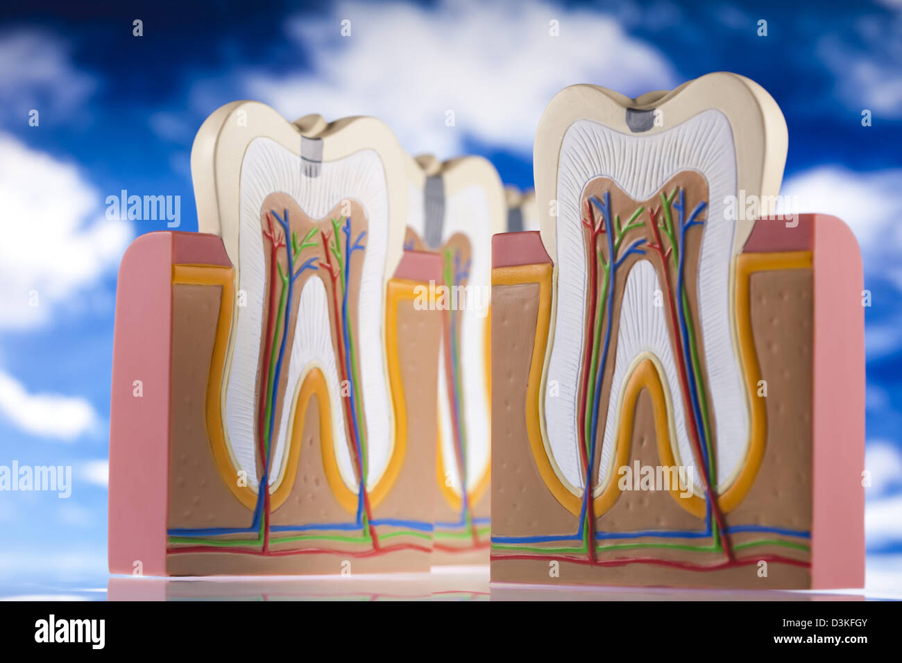 Human tooth structure with caries Stock Photo - Alamy