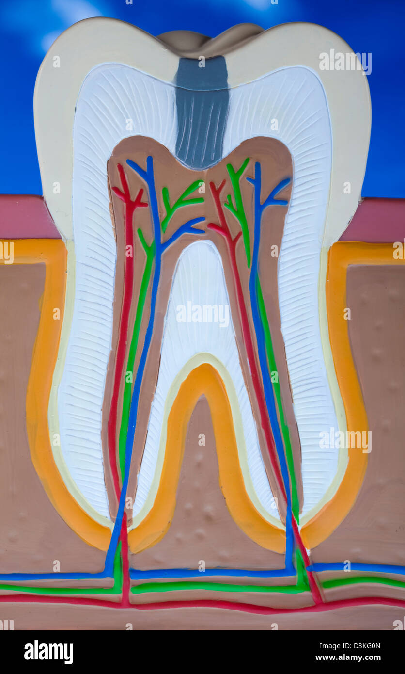 Human tooth structure with caries Stock Photo - Alamy