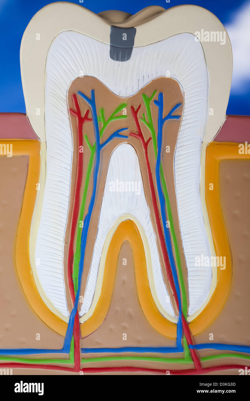 Human tooth structure with caries Stock Photo - Alamy