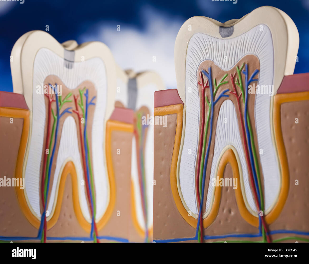 Human tooth structure with caries,blue sky Stock Photo - Alamy