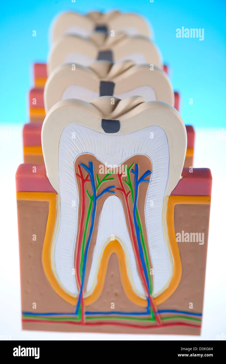 Human tooth structure with caries Stock Photo - Alamy
