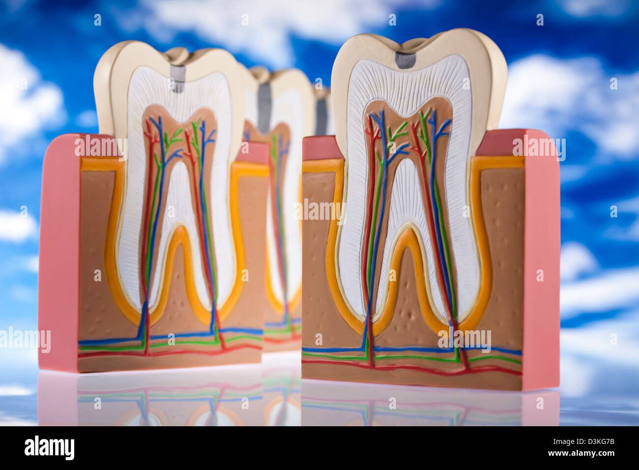 Human tooth structure with caries,blue sky Stock Photo - Alamy