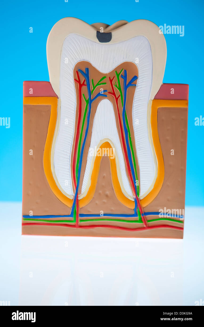 Anatomy of the tooth with caries Stock Photo - Alamy