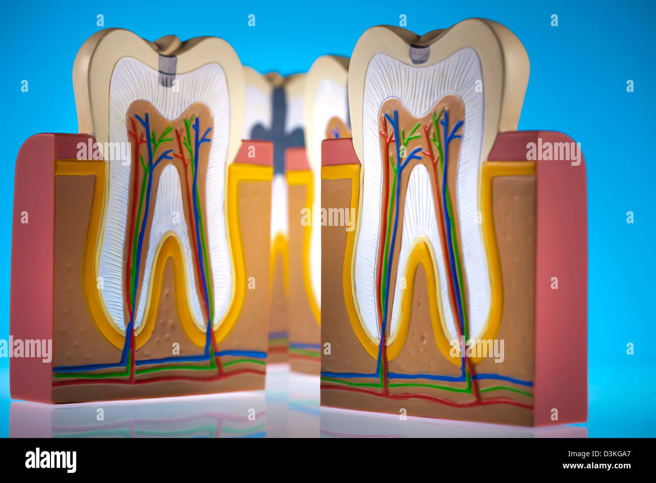 Human tooth structure with caries Stock Photo - Alamy