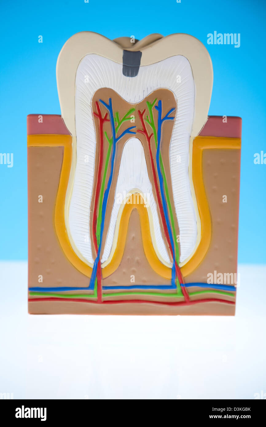Anatomy of the tooth with caries Stock Photo - Alamy