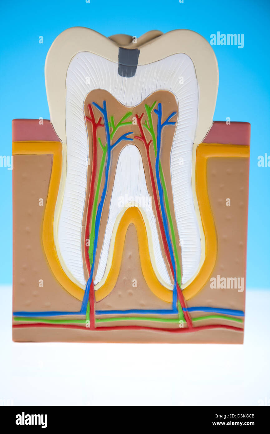 Anatomy of the tooth with caries Stock Photo - Alamy