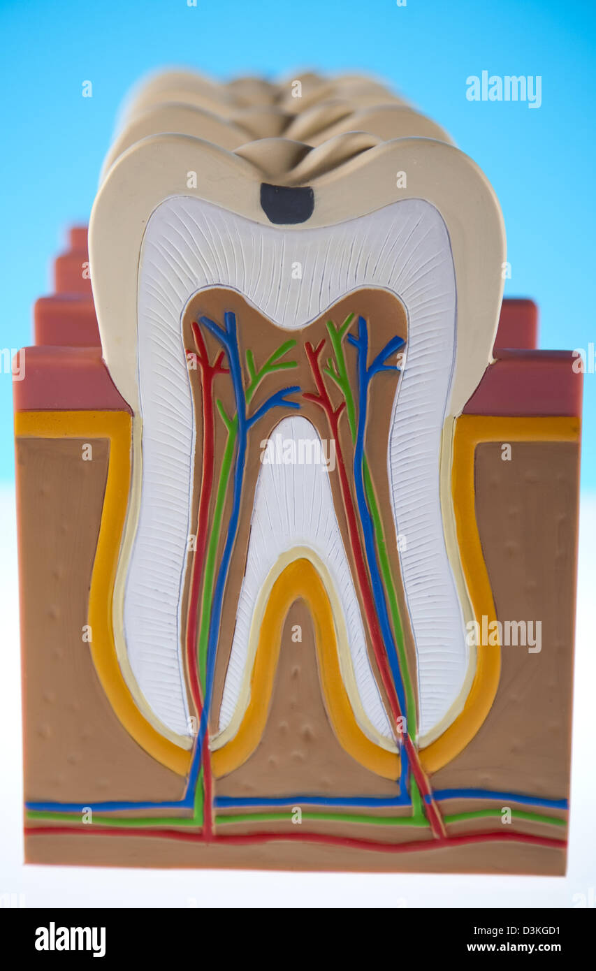 Anatomy of the tooth with caries Stock Photo - Alamy