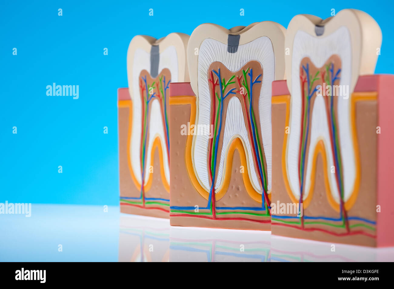 Human tooth structure with caries Stock Photo - Alamy