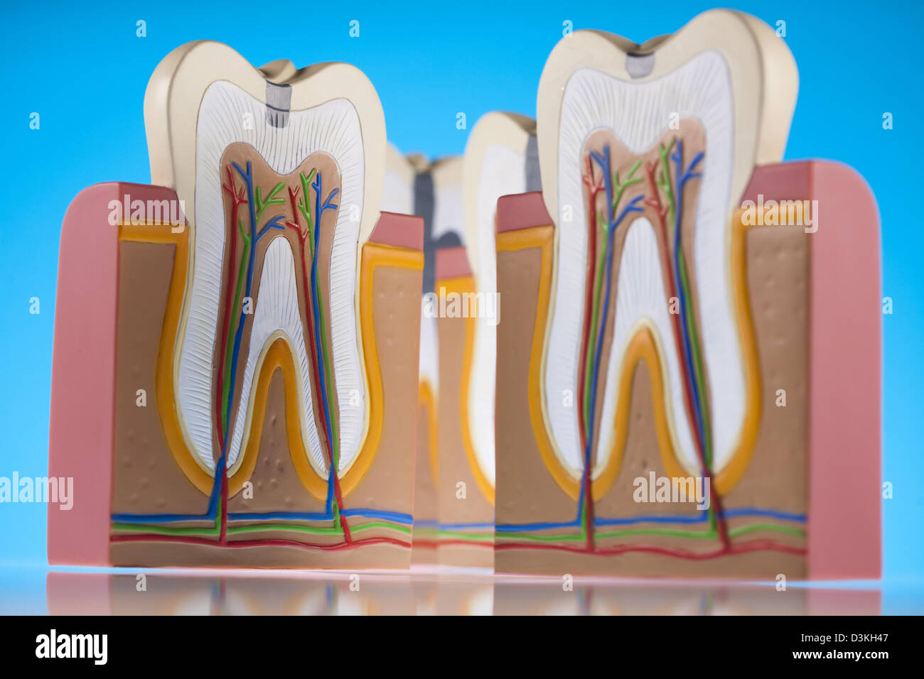Human tooth structure with caries Stock Photo - Alamy