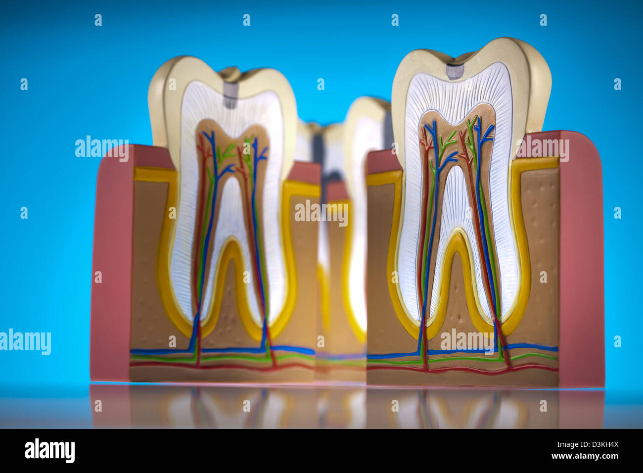 Human tooth structure with caries Stock Photo - Alamy