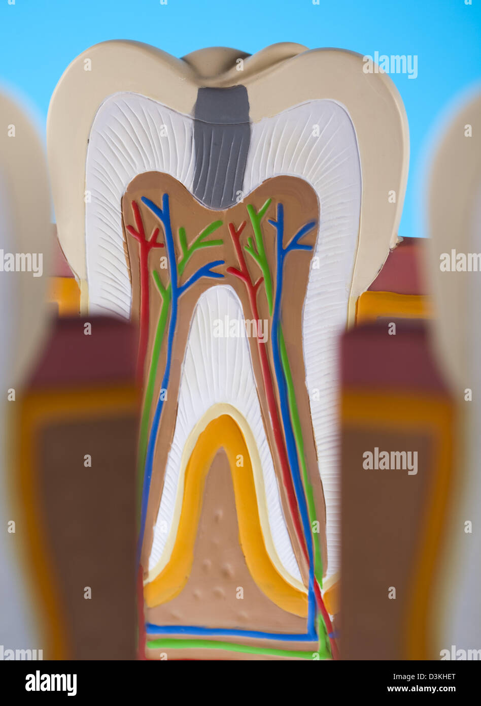 Human tooth structure with caries Stock Photo - Alamy