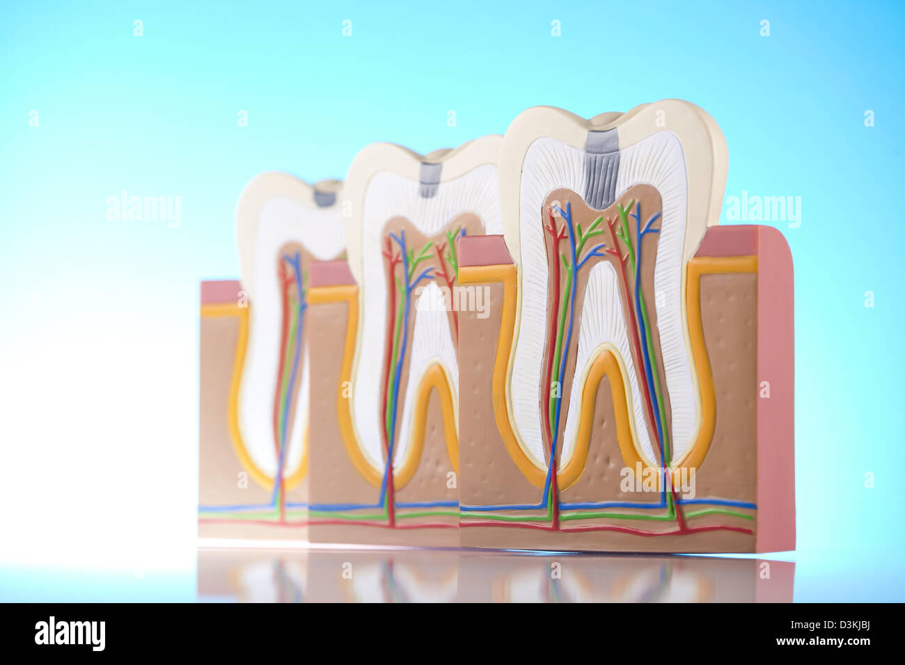 Human tooth structure with caries Stock Photo - Alamy