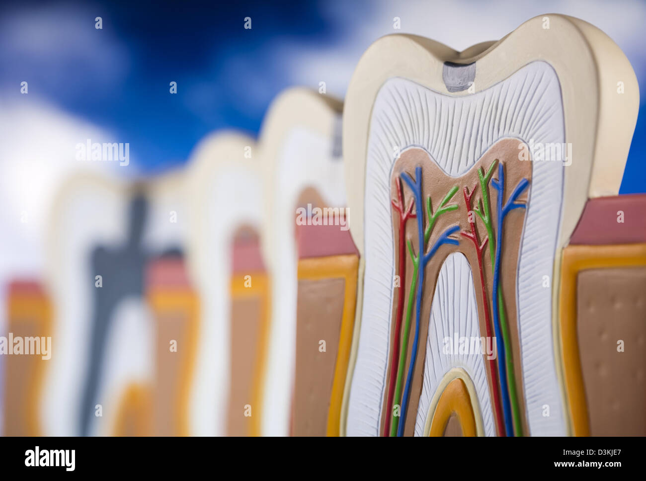 Human tooth structure with caries Stock Photo - Alamy