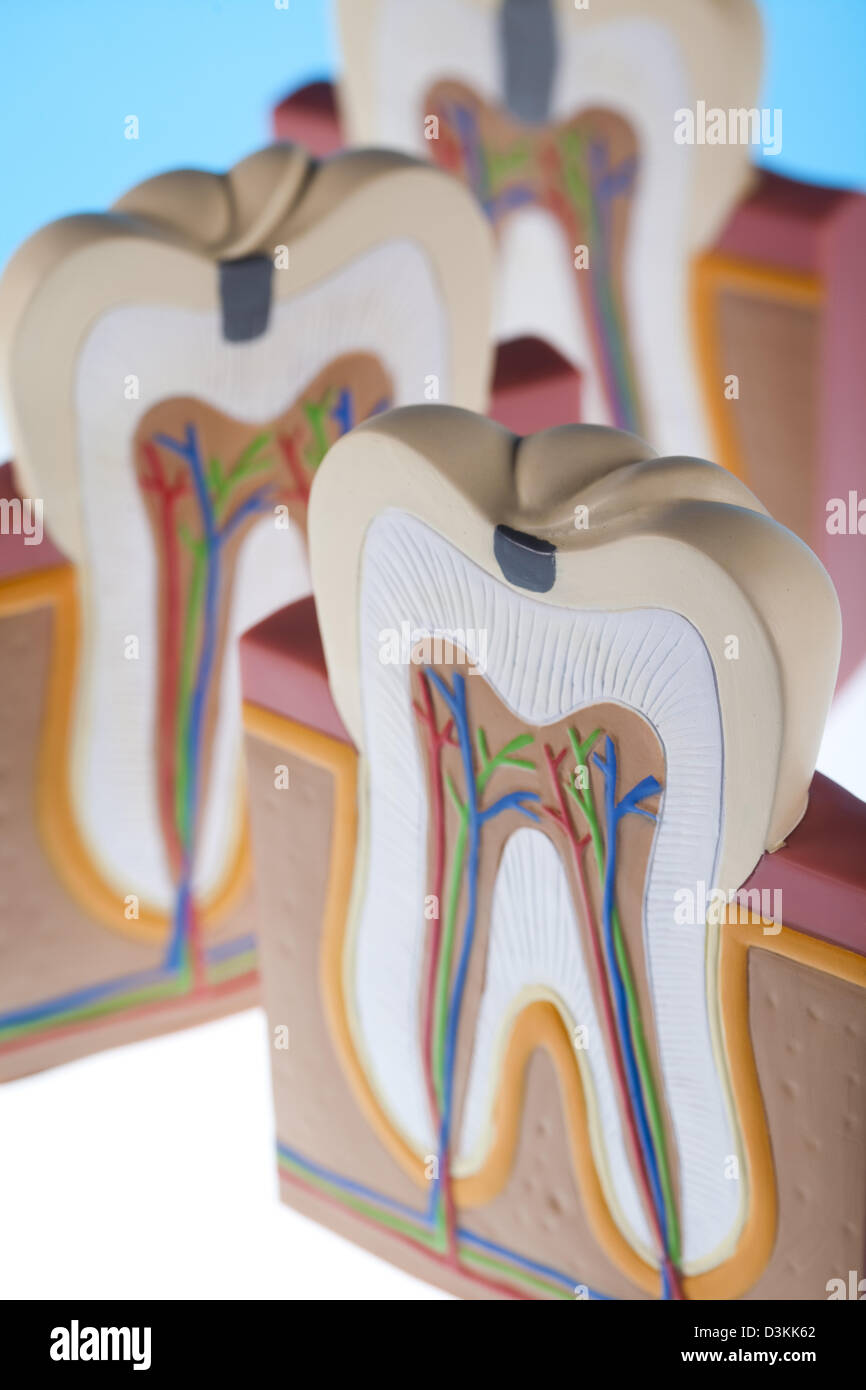 Anatomy of the teeth with caries Stock Photo - Alamy