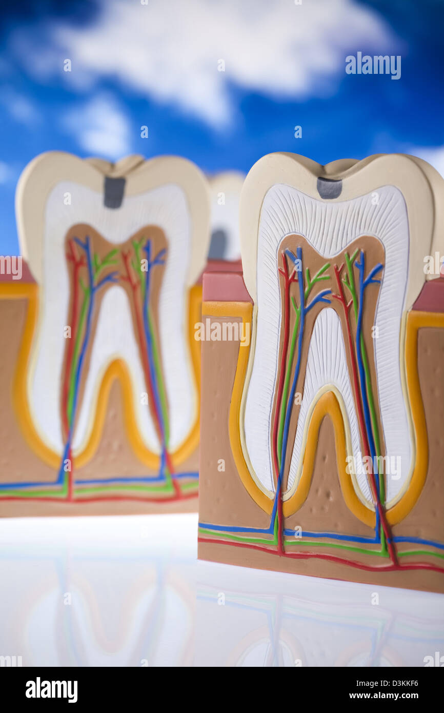 Human tooth structure with caries,blue sky Stock Photo - Alamy