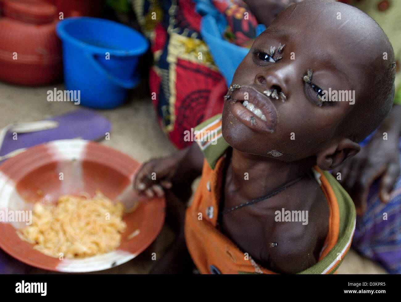 (dpa) - A child suffering from severe malnutrition gets fed in the ...