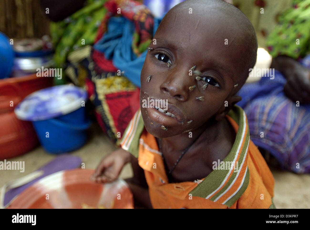 (dpa) - The picture shows a child suffering from severe malnutrition in ...