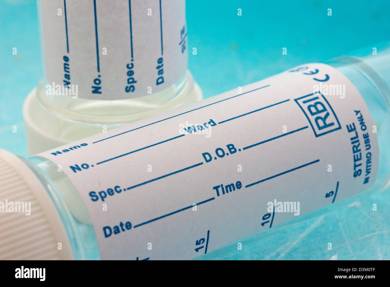 Detail photo of two specimen tubes Stock Photo - Alamy