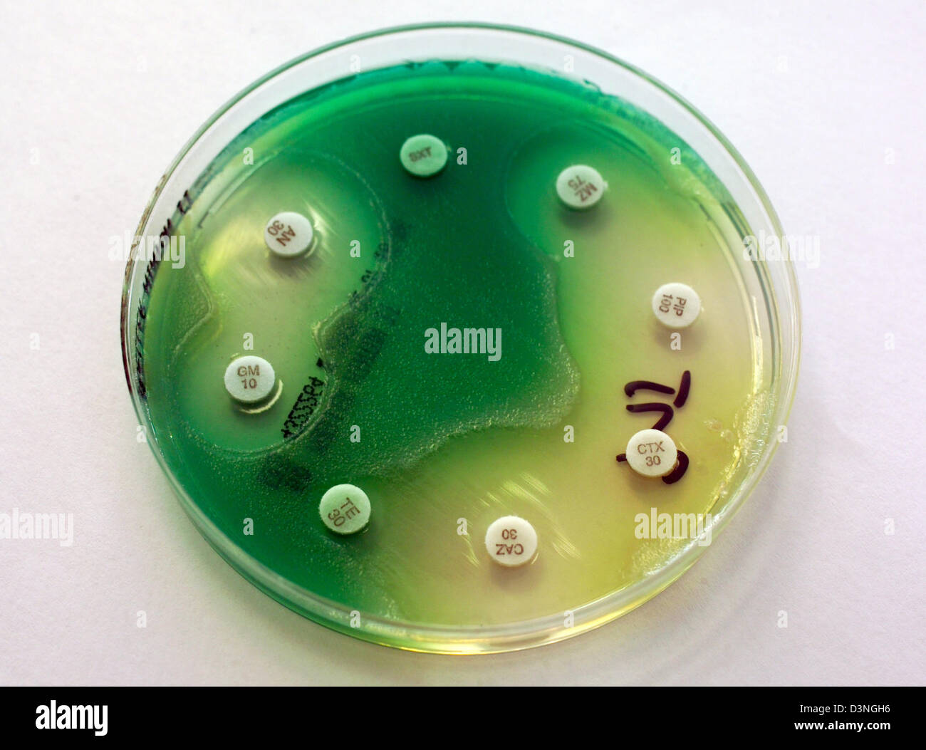 Pseudomonas Aeruginosa Culture
