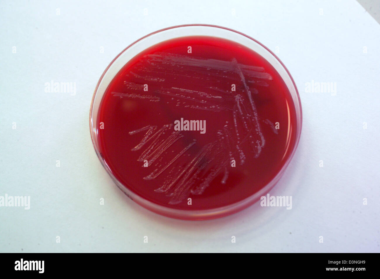Blood Agar Streptococcus Pyogenes