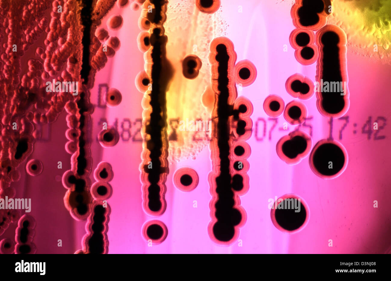 Xld Agar Uninoculated