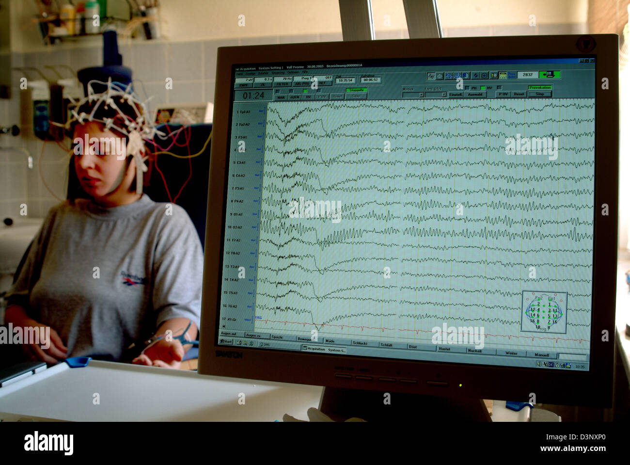 Cerebr hi-res stock photography and images - Alamy