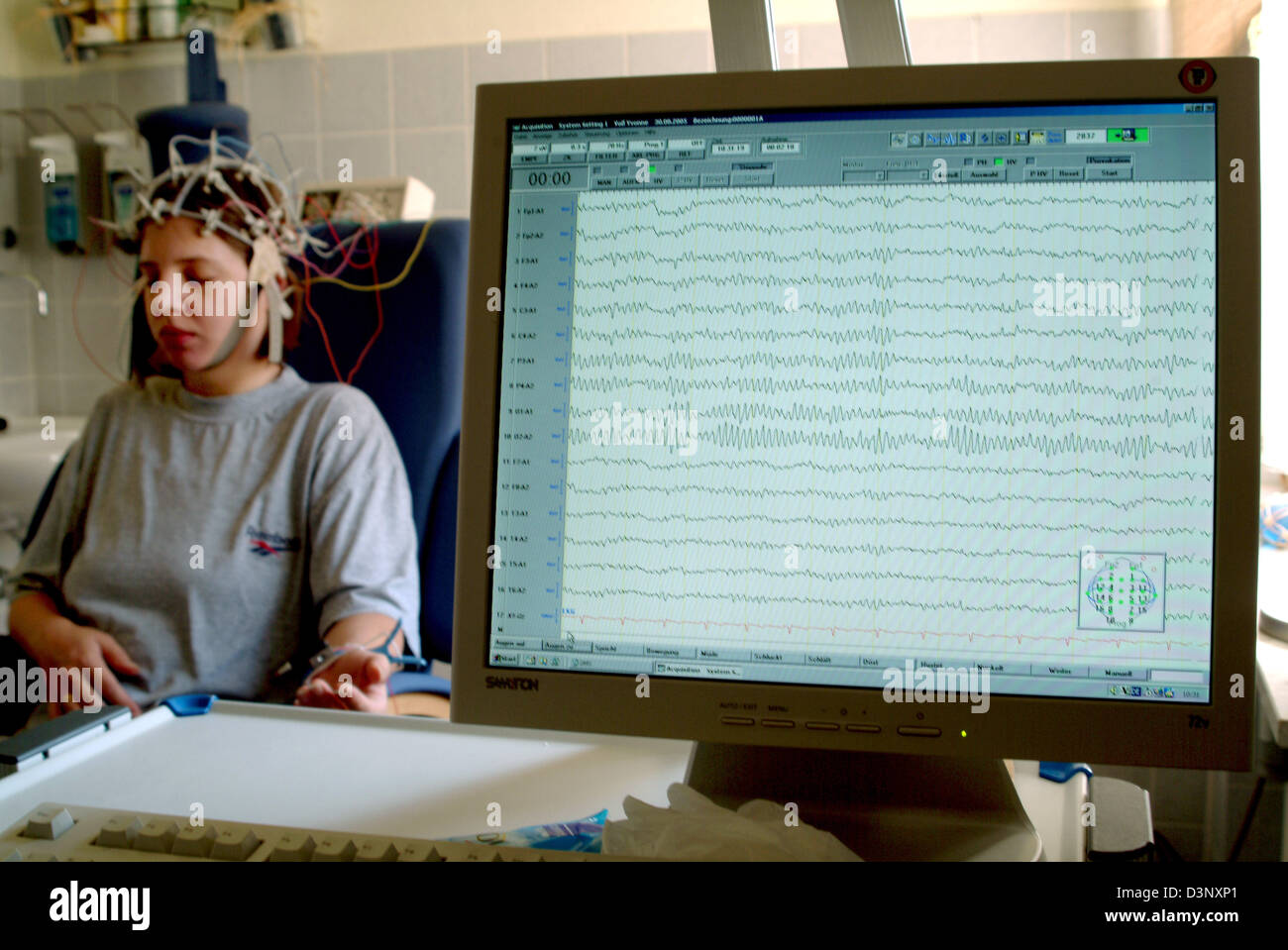 A patient undergoes an EEG in a neurologist surgery in Iserlohn ...