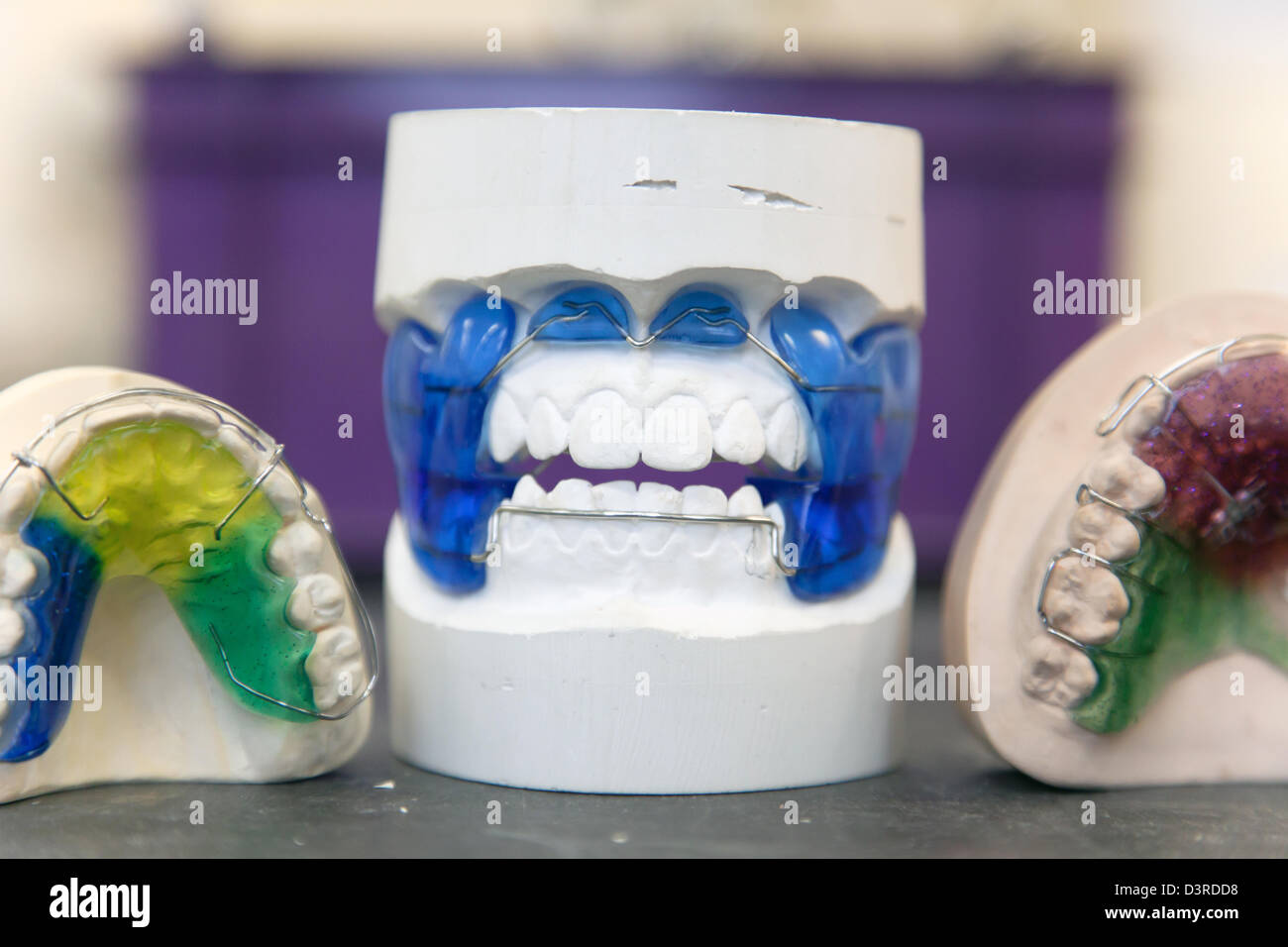 Berlin, Germany, braces against tooth and jaw deformities Stock Photo ...
