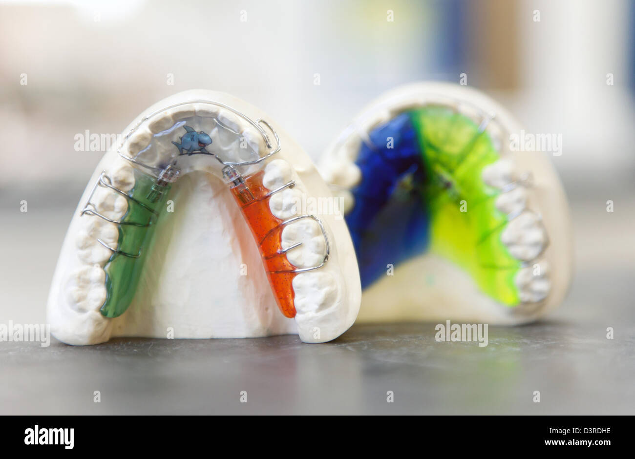 Berlin, Germany, braces against tooth and jaw deformities Stock Photo ...