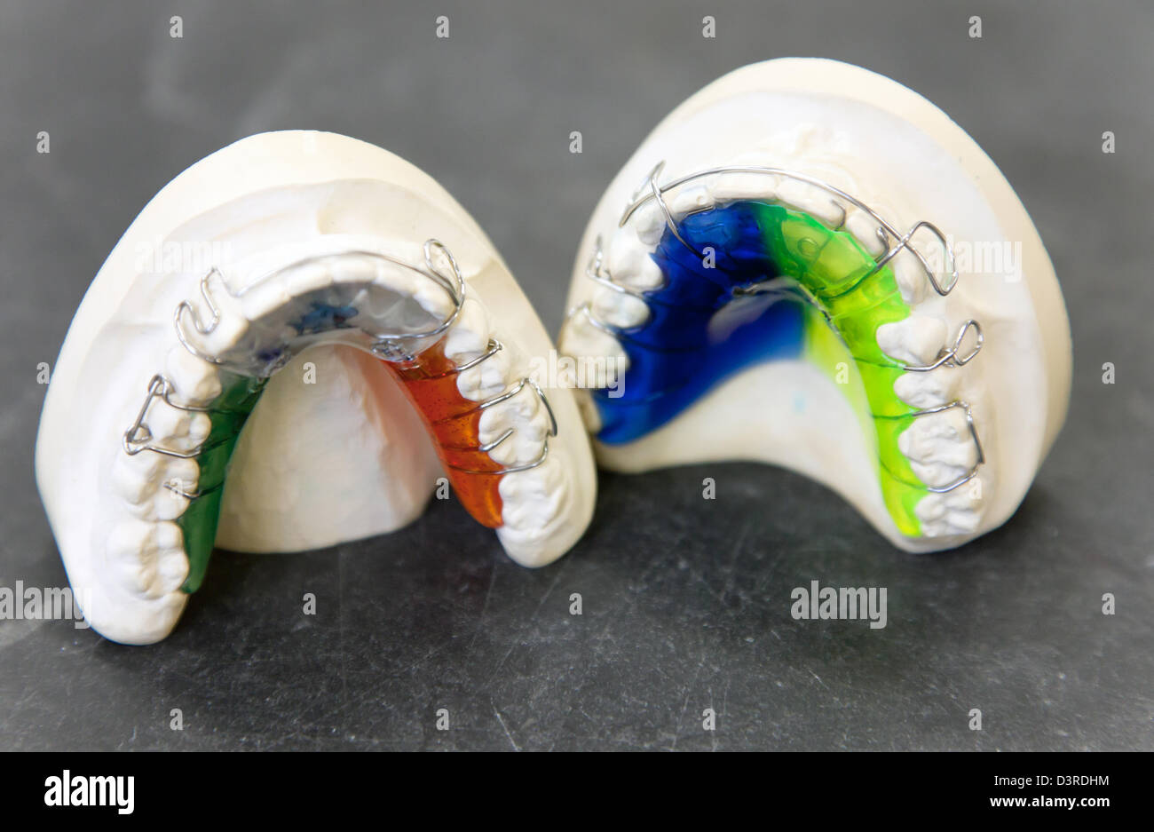 Berlin, Germany, braces against tooth and jaw deformities Stock Photo ...