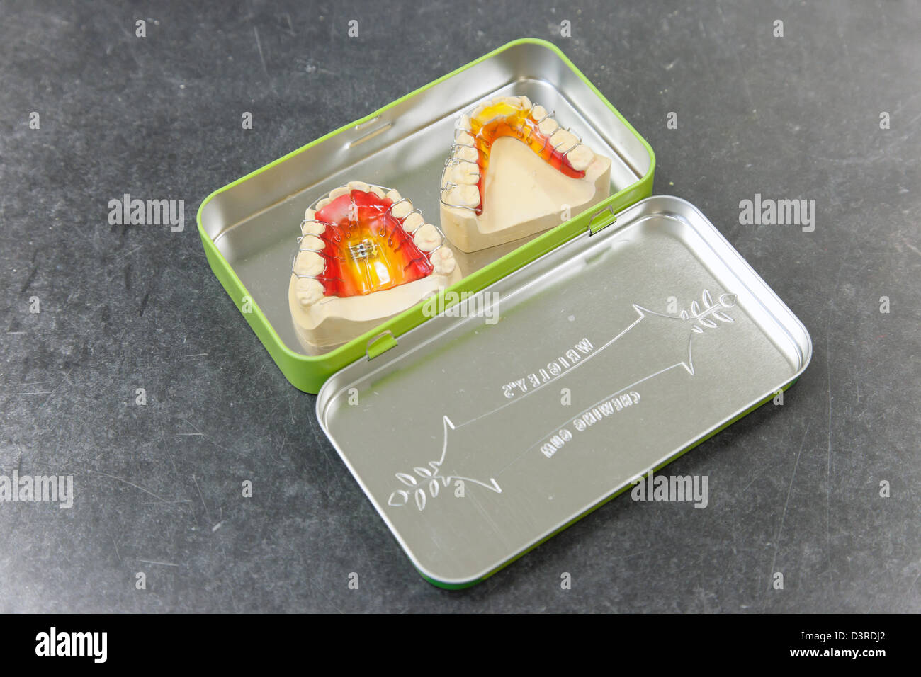 Berlin, Germany, braces against tooth and jaw deformities Stock Photo ...