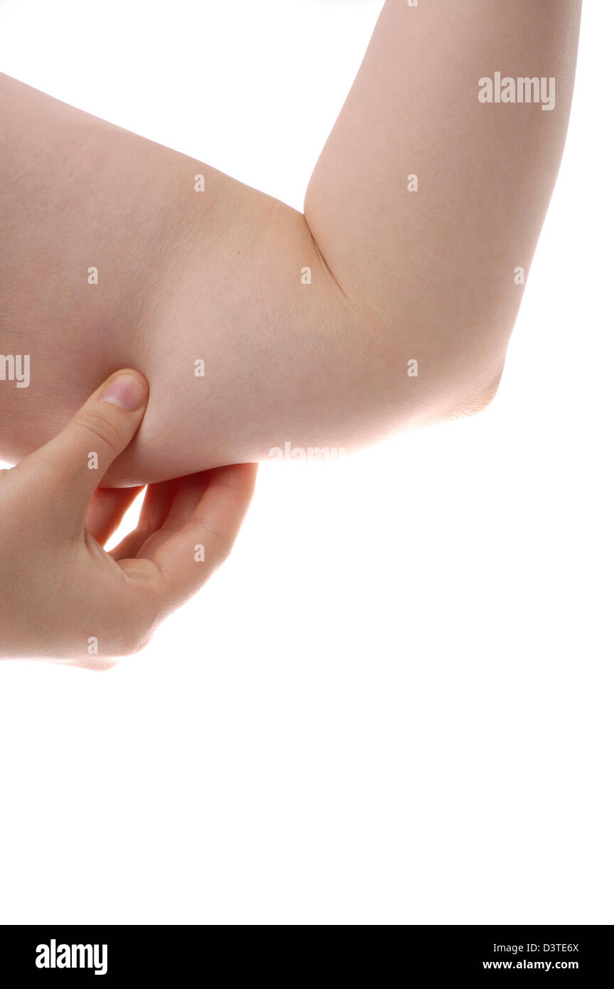 Woman's hand shown pinching her upper arm, checking for fat or flab ...