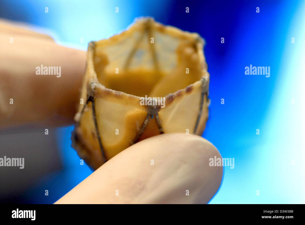 The undated picture shows the first injectable artificial heart valve ...