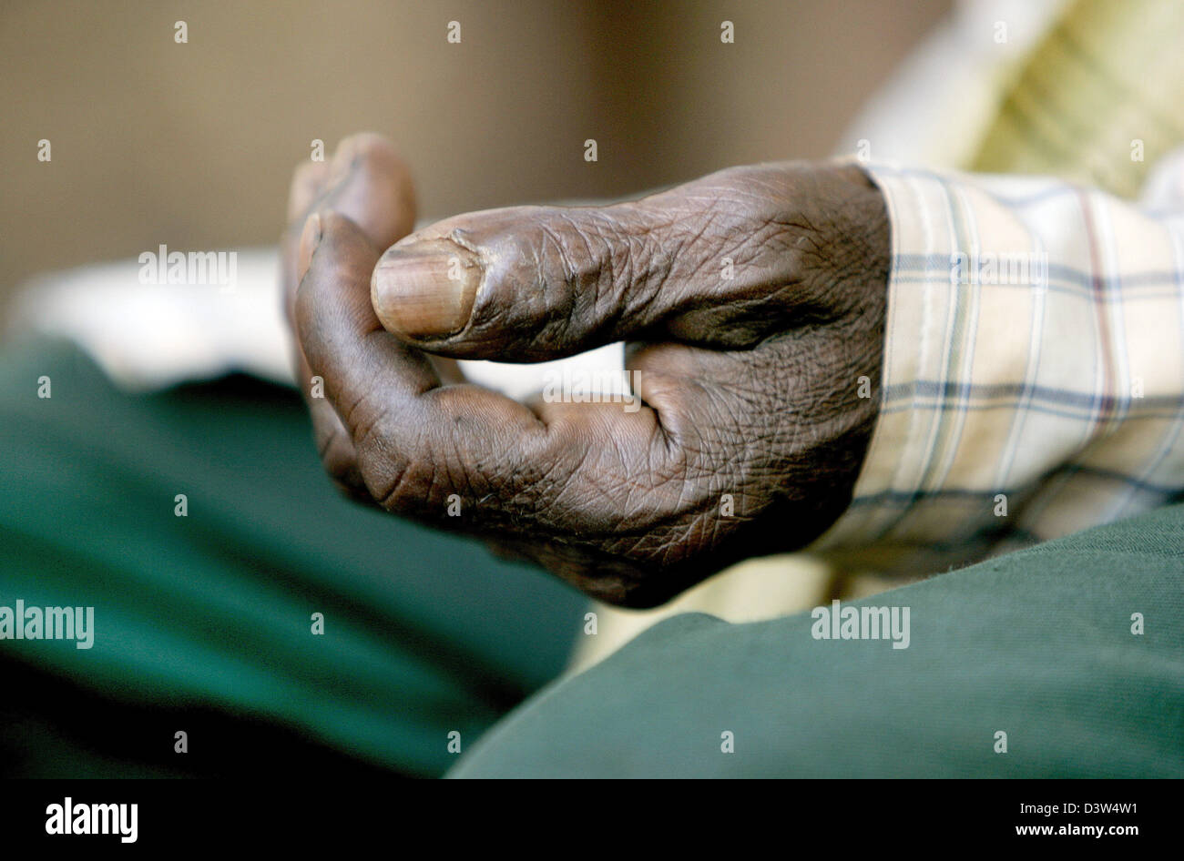 The picture shows the callous hand of an old man in the village of ...