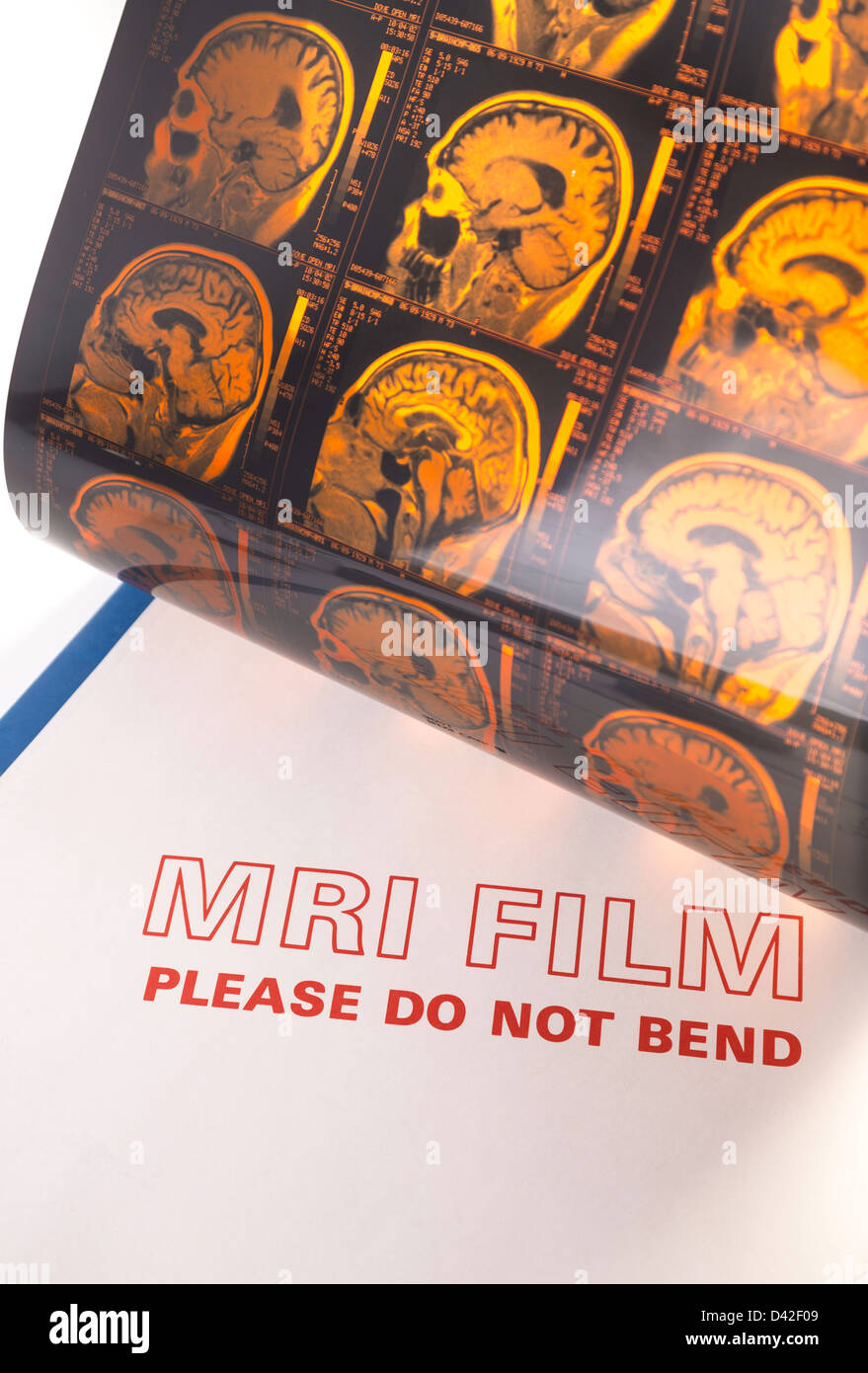 Magnetic Resonance Imaging (MRI) Film and Folder, USA 2013 Stock Photo ...