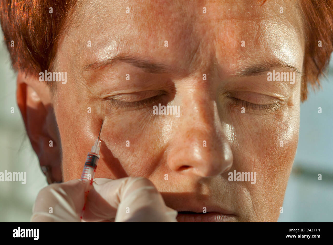 Skin close up syringe hi-res stock photography and images - Alamy