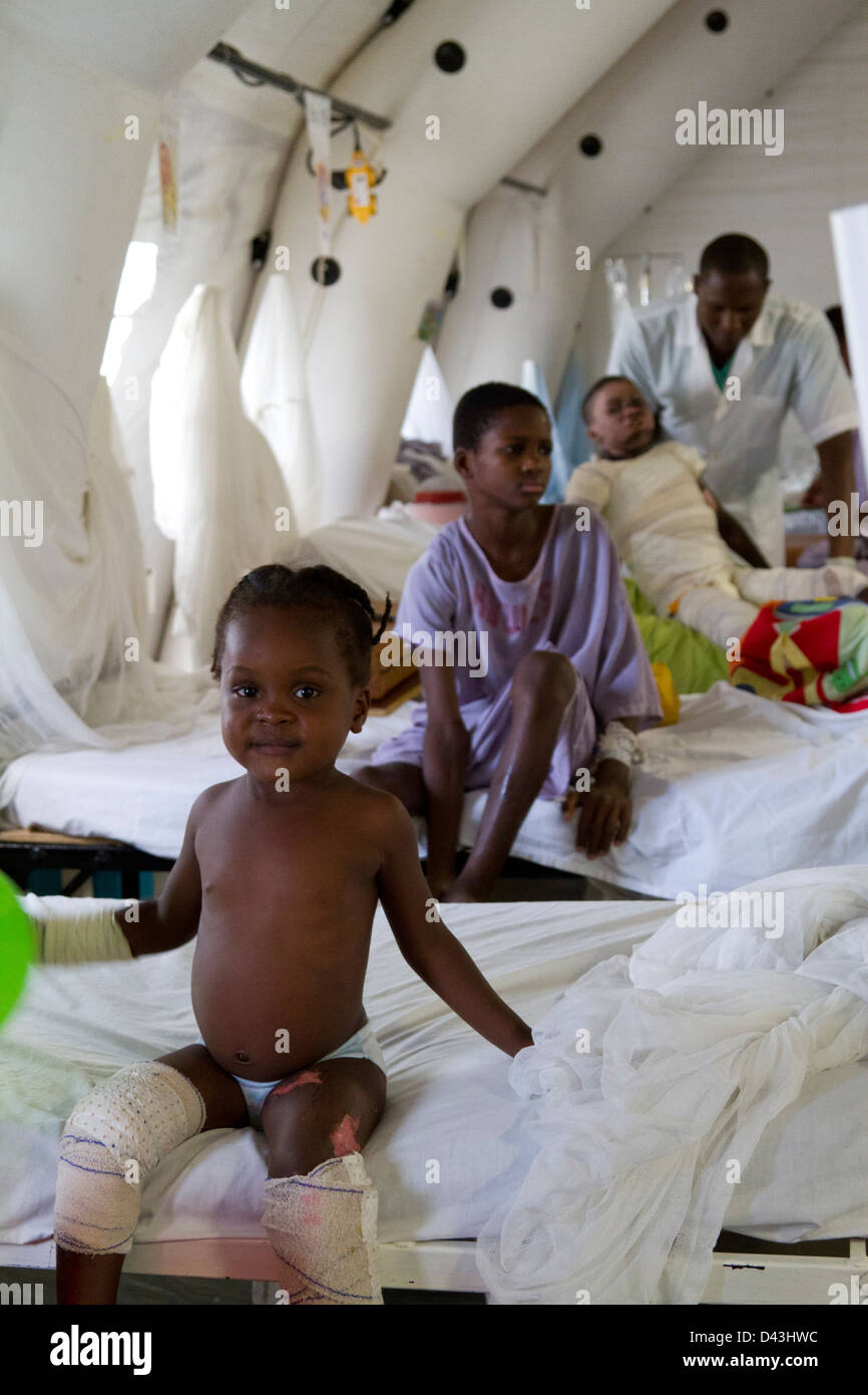 children playing with balloon in the burn unit in Drouillard Hospital ...