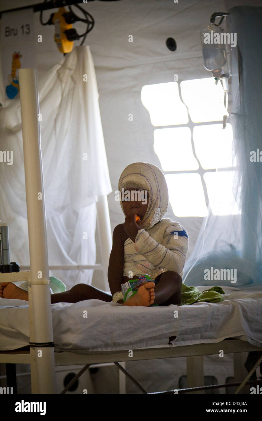 children playing with balloon in the burn unit in Drouillard Hospital ...