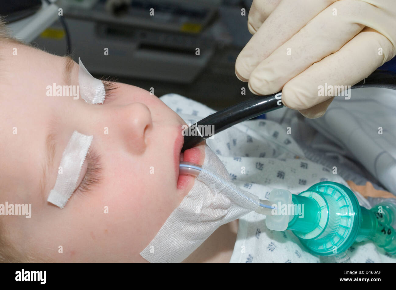A young boy being prepared for an endoscopic procedure Stock Photo - Alamy