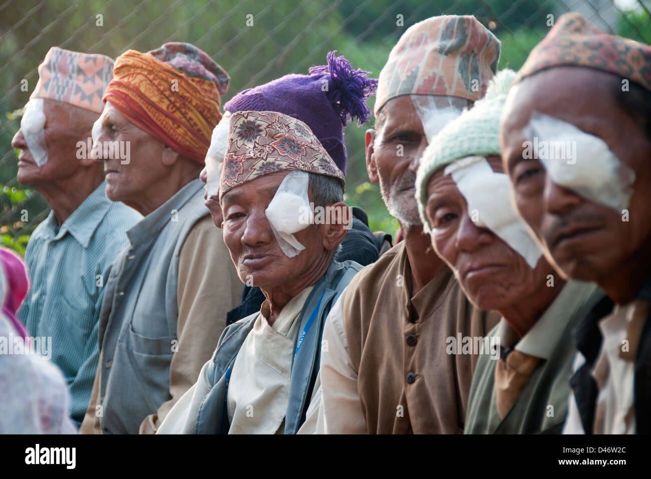 Cataract eyes indian hi-res stock photography and images - Alamy