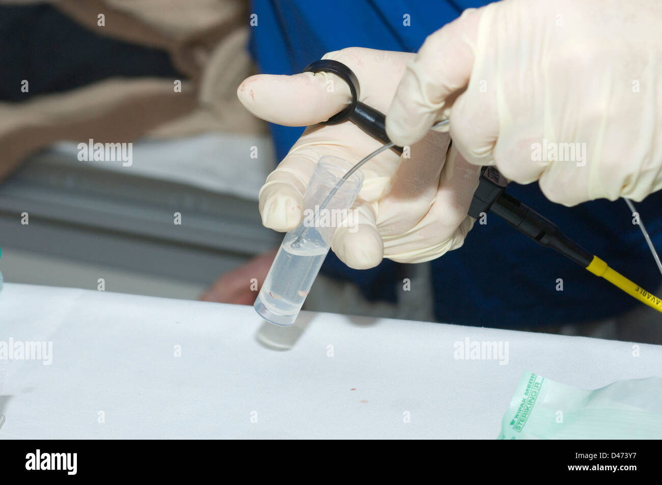 Surgical probe hi-res stock photography and images - Alamy