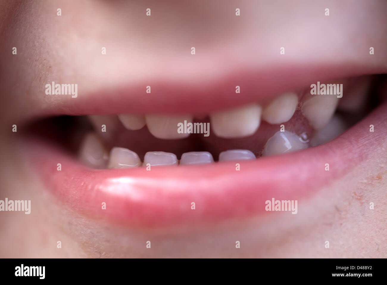 Young Girls Mouth and teeth Stock Photo - Alamy