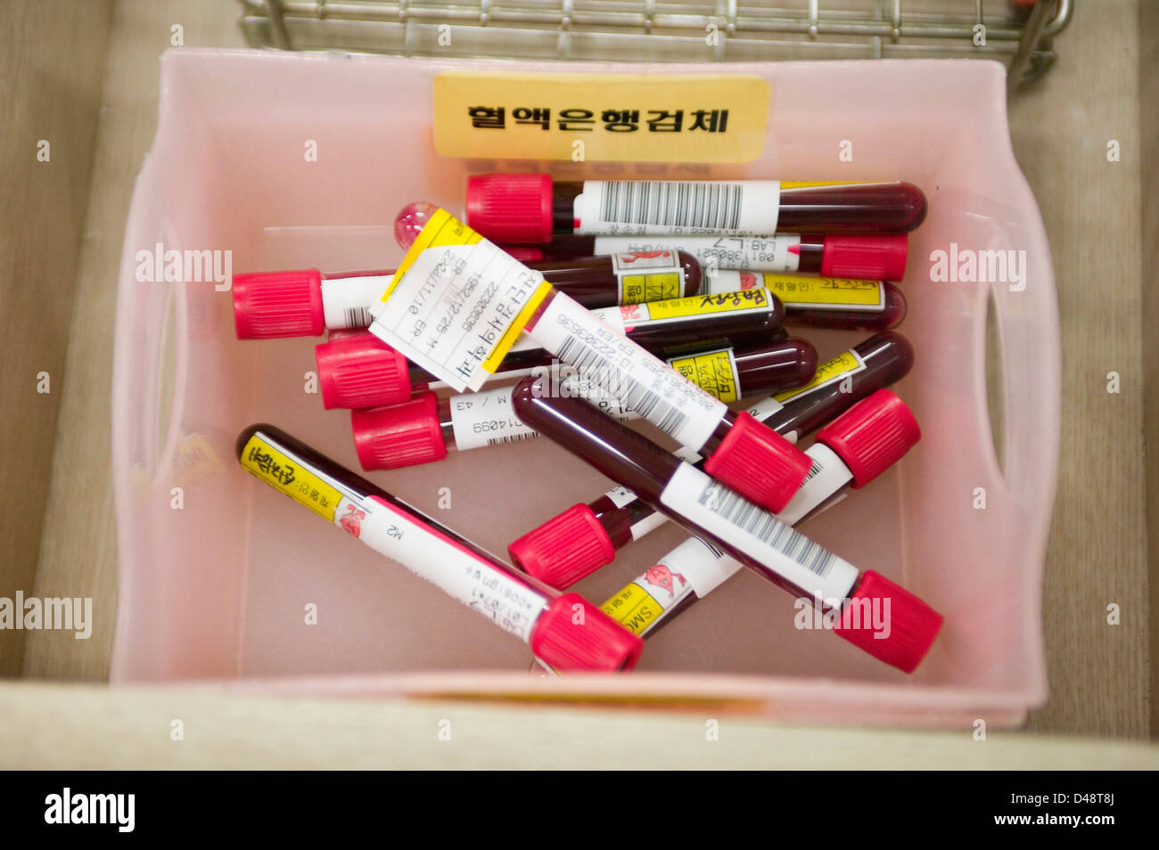 Patients blood is bottled and labelled prior to be investigated to ...