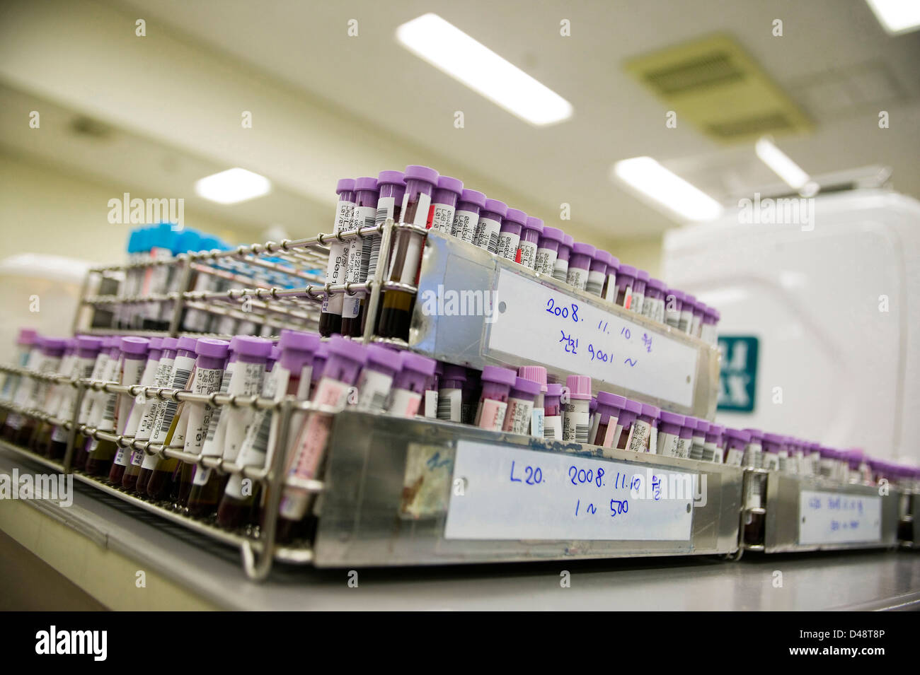 Blood samples seperated types after hi-res stock photography and images ...