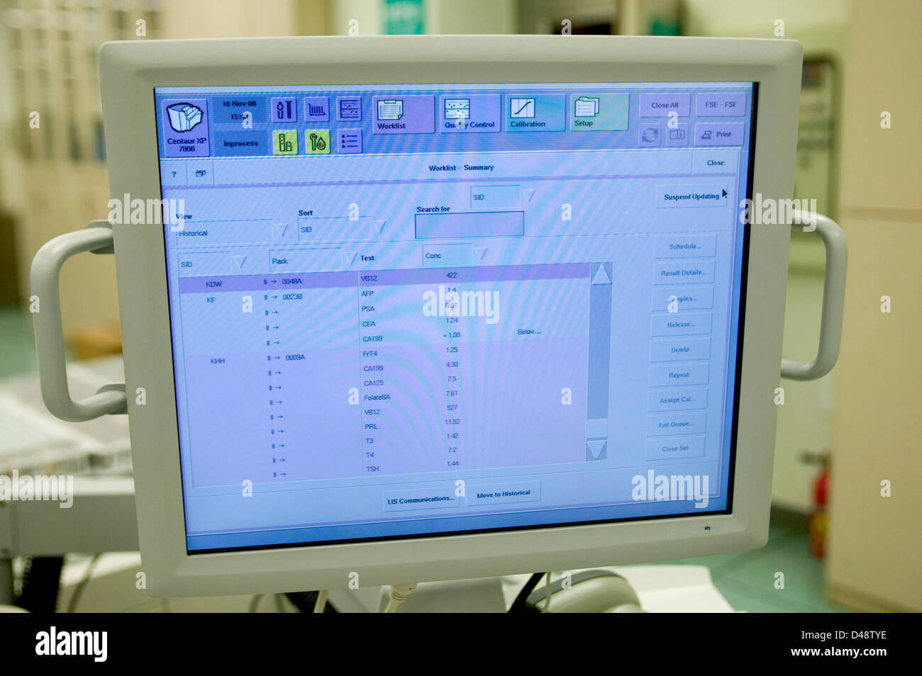 A monitor used in the testing and analysis of blood samples Stock Photo ...