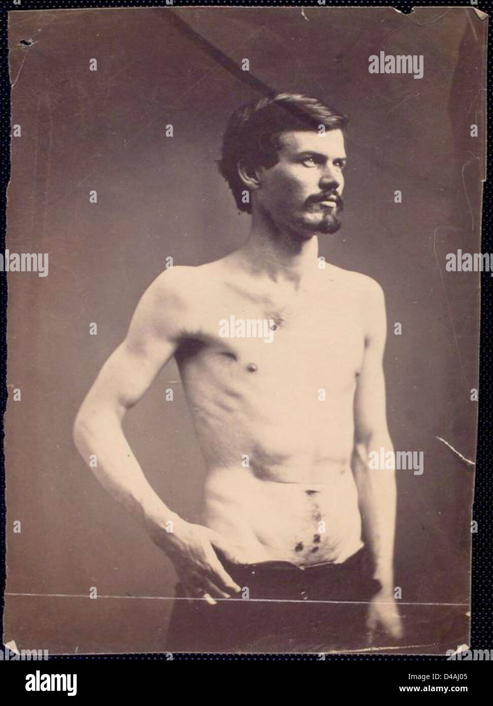A photograph depicting James Brownlee, a Civil War soldier, showing the ...