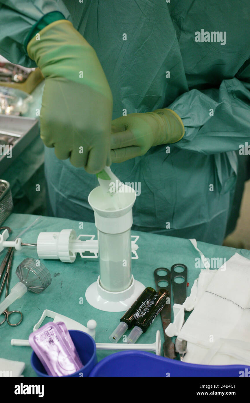 Orthopedic cement being mixed during Hemiarthroplasty, Close-up. UK ...