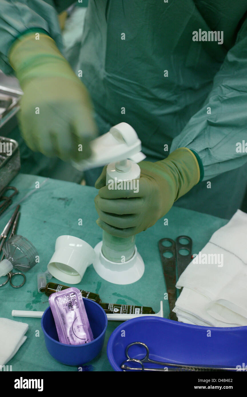 Orthopedic cement being mixed during Hemiarthroplasty, Close-up. UK ...