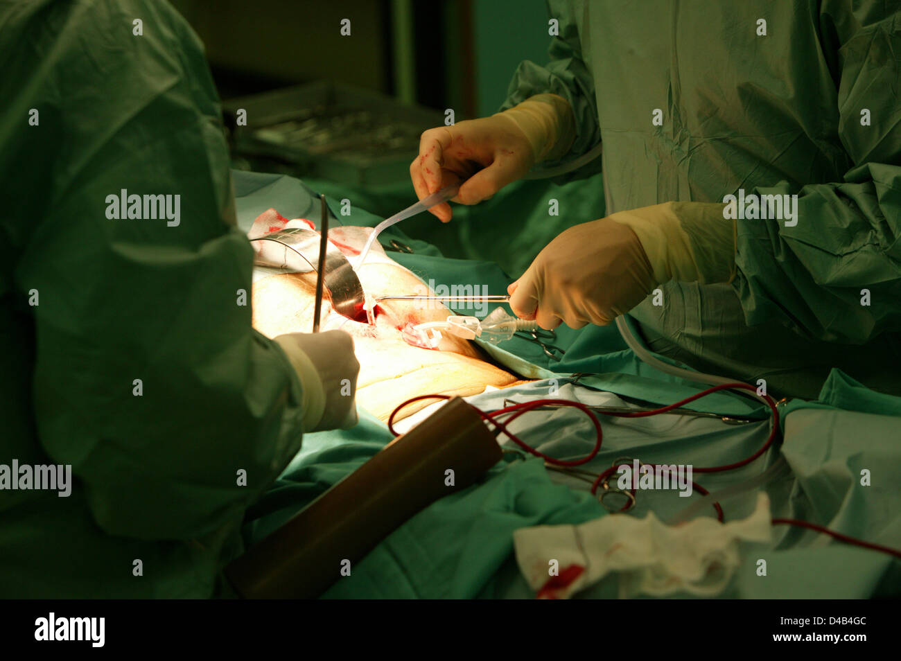 Performing surgery abdomen hi-res stock photography and images - Alamy