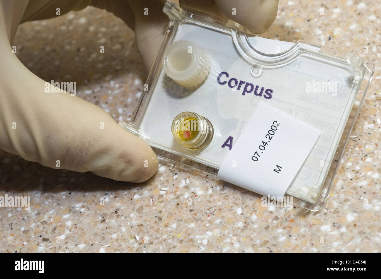 Close-up of medical samples Stock Photo - Alamy